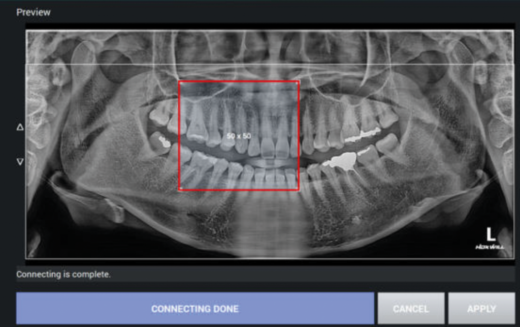 HDX Will eco-x – CoSi dental GmbH