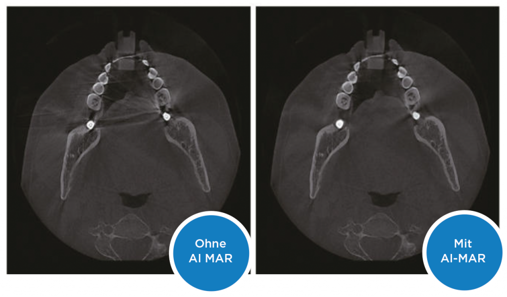 HDX Will eco-x – CoSi dental GmbH