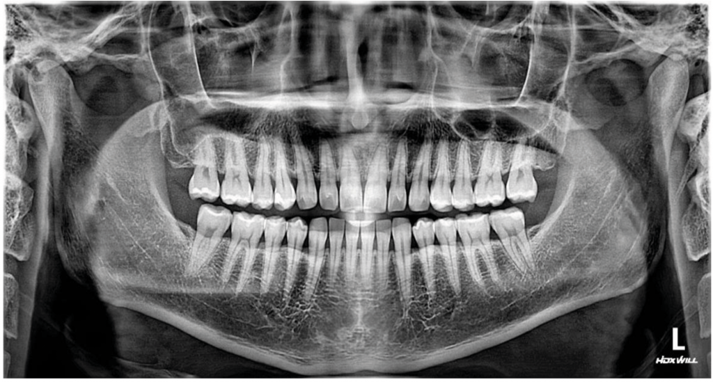 HDX Will eco-x – CoSi dental GmbH