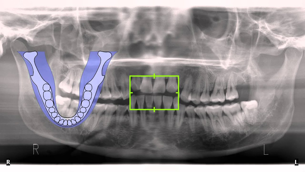 Morita Veraviewepocs 3D R100 – CoSi dental GmbH